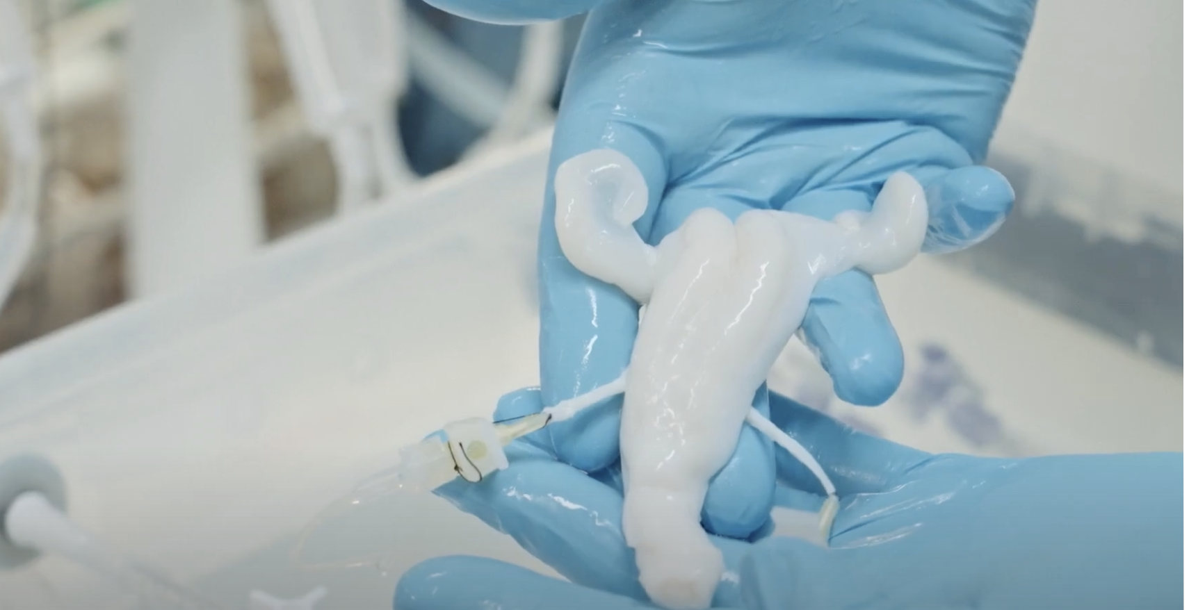 World’s First Baby Born By A Transplanted Uterus That Was Implanted By ...